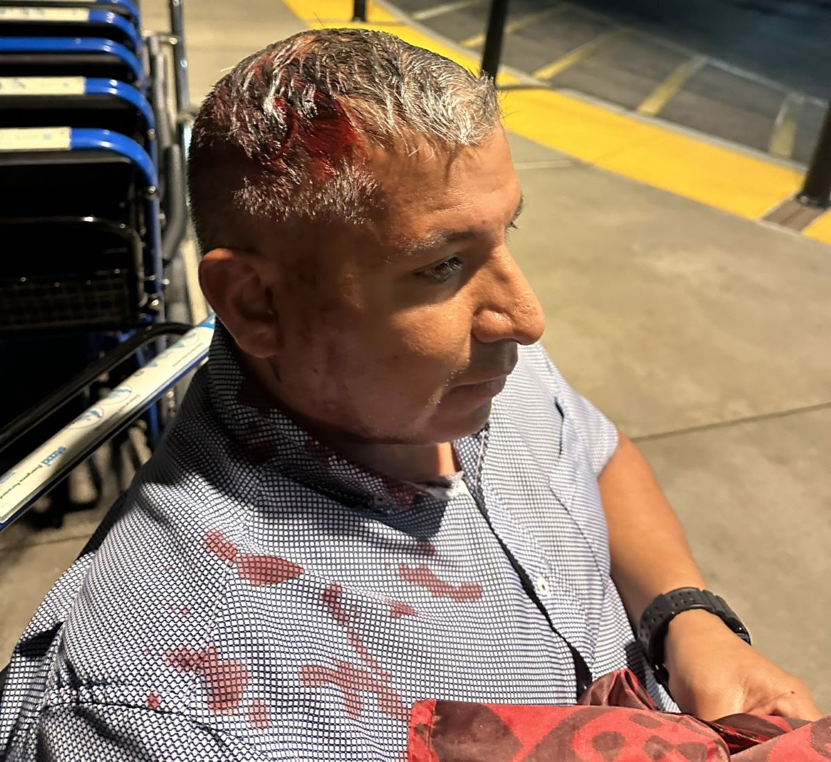 Man shot in head by OC Deputy at Santa Ana ICE protest seeks $50M in ...